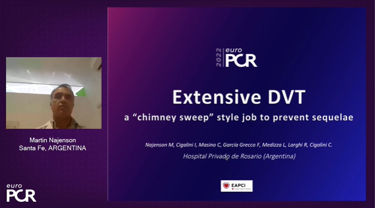PCR 2022 | Extensive DVT a "chimney sweep" style job to prevent sequelae - SCITE