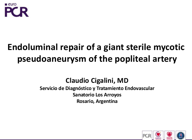 EuroPCR 2013 | Endoluminal repair of a giant sterile mycotic ...