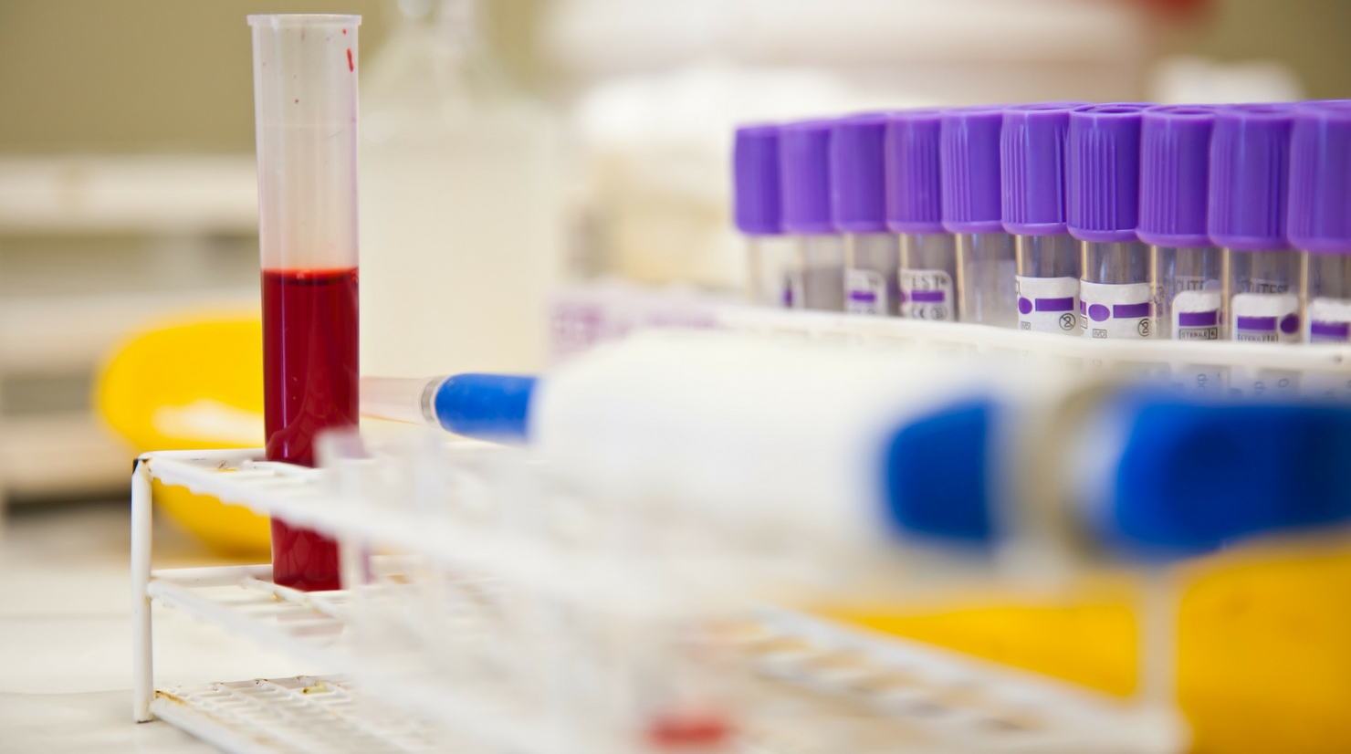 Manejo de la anemia en pacientes con cardiopatías - SCITE